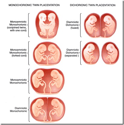 seswati: kehamilan kembar